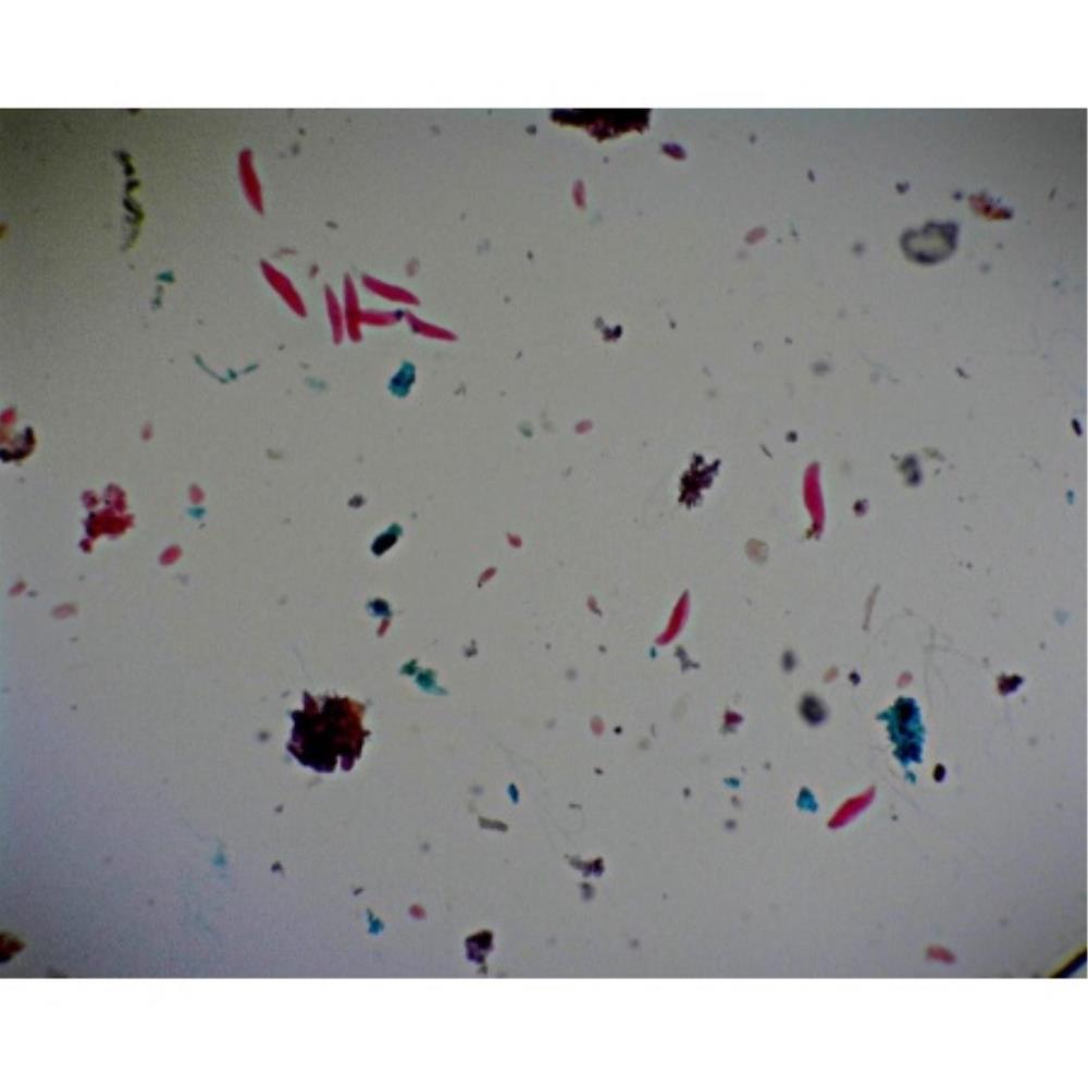 Mixed Protozoa | BB1214 | SE