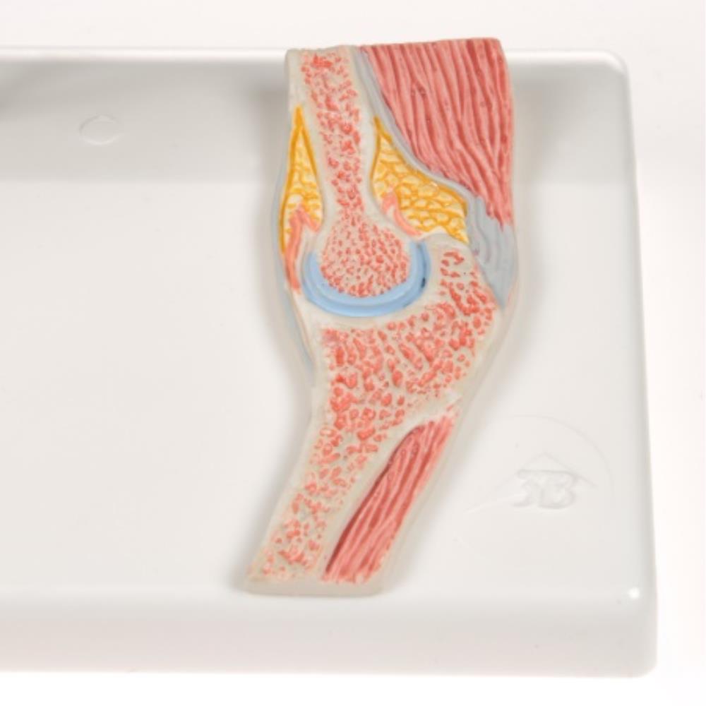 3B Mini Functional Elbow Joint | SE1000174 | 3B SCIENTIFIC | SE