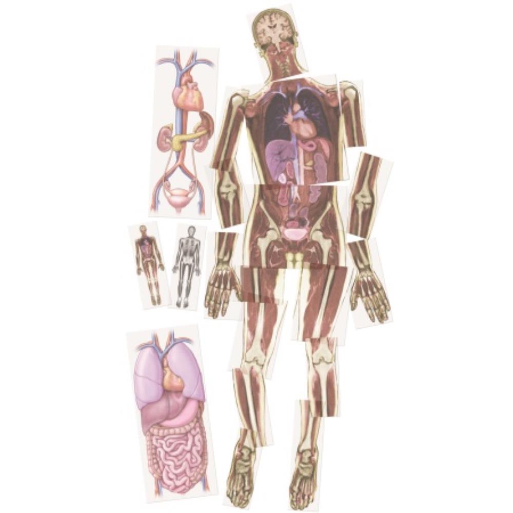 Full Body Colour MRI Scan | SE1016 | SE